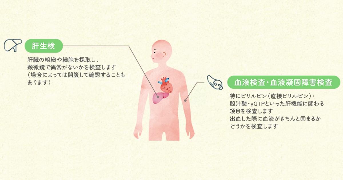 検査・診断について｜進行性家族性肝内胆汁うっ滞症（PFIC）とは｜アラジスとピーフィのひろば アラジール症候群・PFICサポートナビ