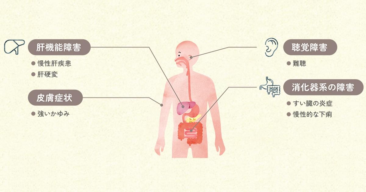 症状・合併症について｜進行性家族性肝内胆汁うっ滞症（PFIC）とは｜アラジスとピーフィのひろば アラジール症候群・PFICサポートナビ